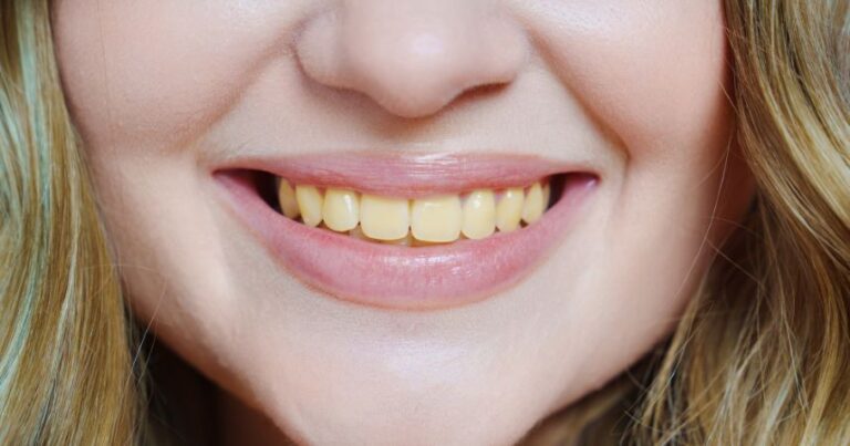How Coke Affects Your Teeth: Dental Krafts' Guide in 2026